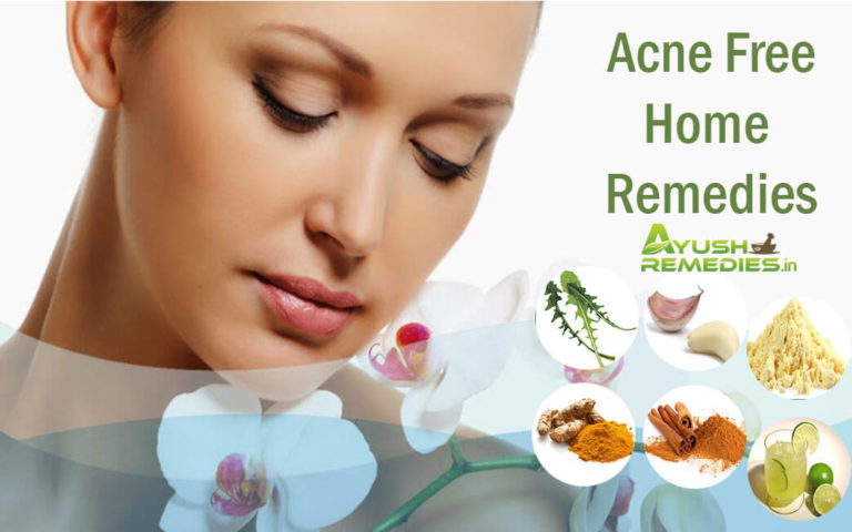 8 Home Remedies For Acne Free Skin - For Smooth And Clear Skin!