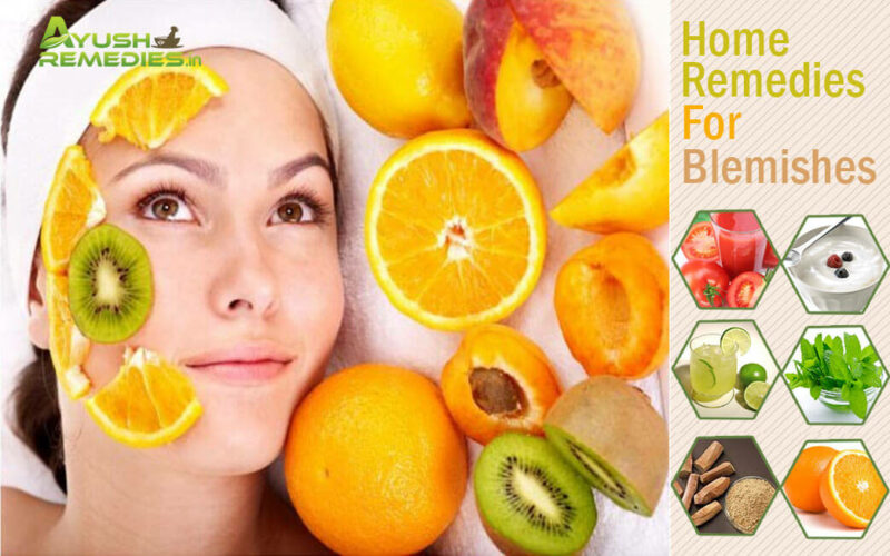 9 Home Remedies for Blemishes - Safe, Easy And Effective!