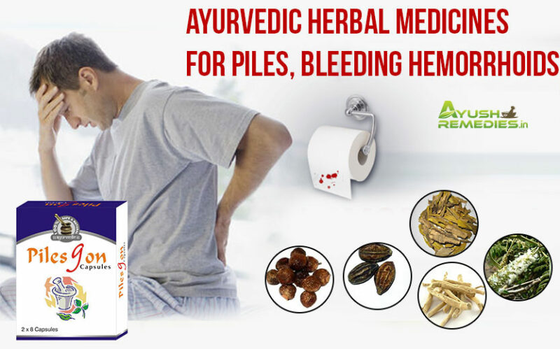 Ayurvedic Herbal Medicines For Piles, Bleeding Hemorrhoids